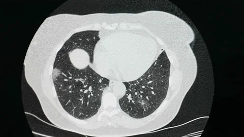 Confirmed Image Stock Videos – Royalty-Free HD & 4K Videos