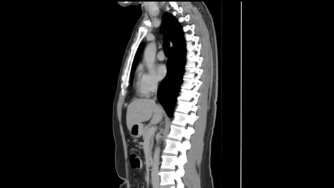 Abdomen Stock Videos – Royalty-Free HD & 4K Videos