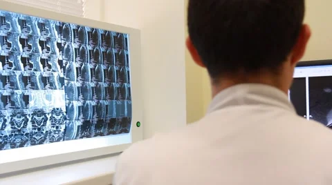 CT scan of the brain on dolly - the doct... | Stock Video | Pond5