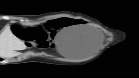 CT scan coronal view with contrast for d... | Stock Video | Pond5