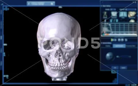 CT Scan of facial bone 3D rendering .: Graphic #208040273