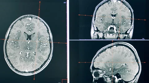 CT scan of human brain in dynamic | Stock Video | Pond5