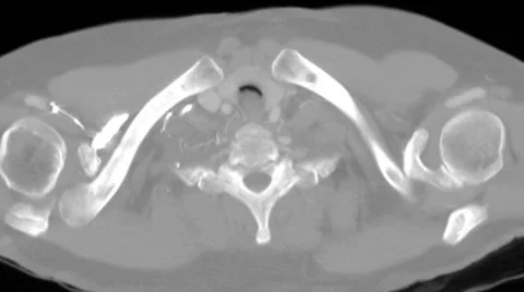 Lung R Stock Videos – Royalty-Free HD & 4K Videos