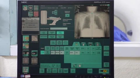 CT scan monitor with lungs checkup repor... | Stock Video | Pond5