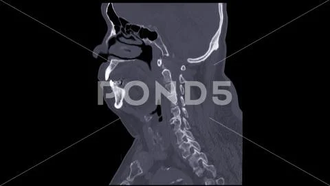A CT scan of the neck sagittal view for diagnostic technique is ...