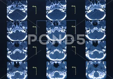 CT scan of thoracic segment. science background Stock Image #52357851