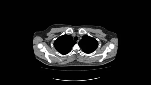 Ct Stock Footage ~ Royalty Free Stock Videos | Pond5