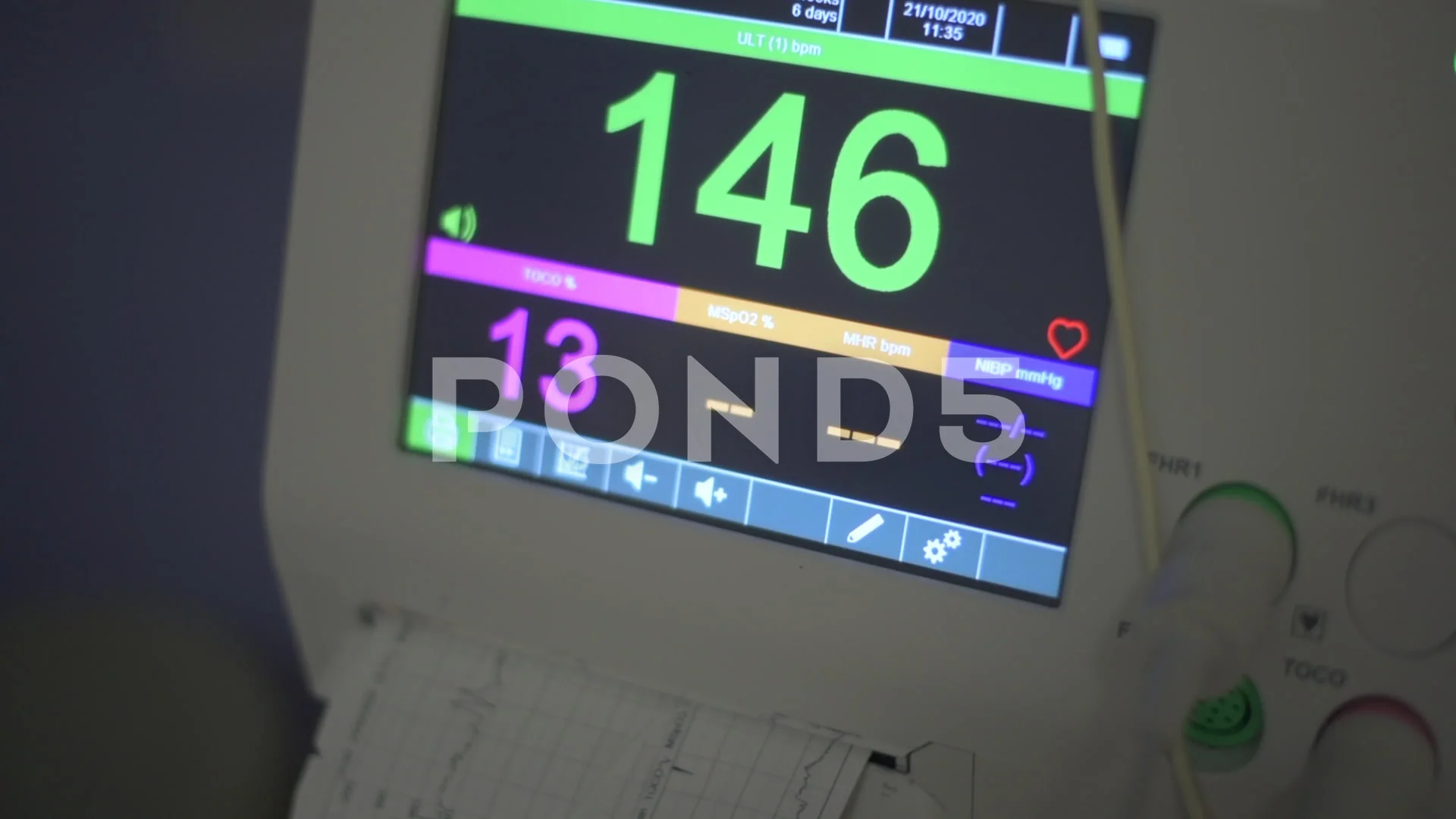 Philips NST AValon FM20 Fetal Heart Rate Monitor How To Use, 56% OFF