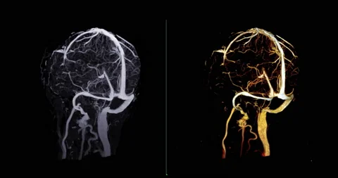 Ctv Stock Video Footage | Royalty Free Ctv Videos | Pond5