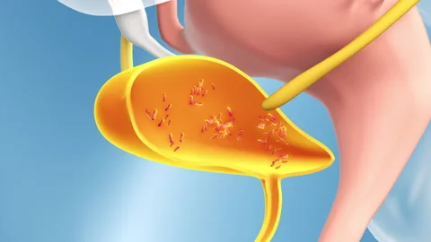 Urinary Tract Infection Stock Videos – Royalty-Free HD & 4K Videos | Pond5