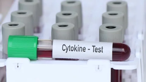 Cytokine Stock Videos – Royalty-Free HD & 4K Videos