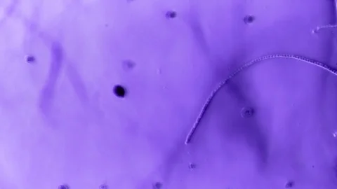 Microscopic Protozoa Stock Video Footage | Royalty Free Microscopic ...