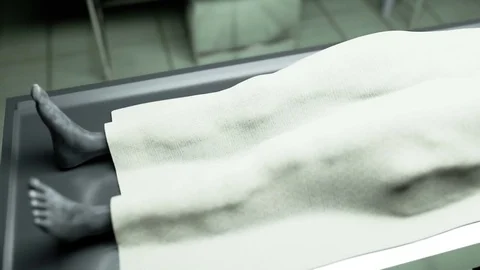 The dead alien in the morgue on the tabl... | Stock Video | Pond5