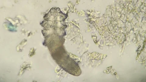 Demodex Face Mite Under the Microscope | Stock Video | Pond5