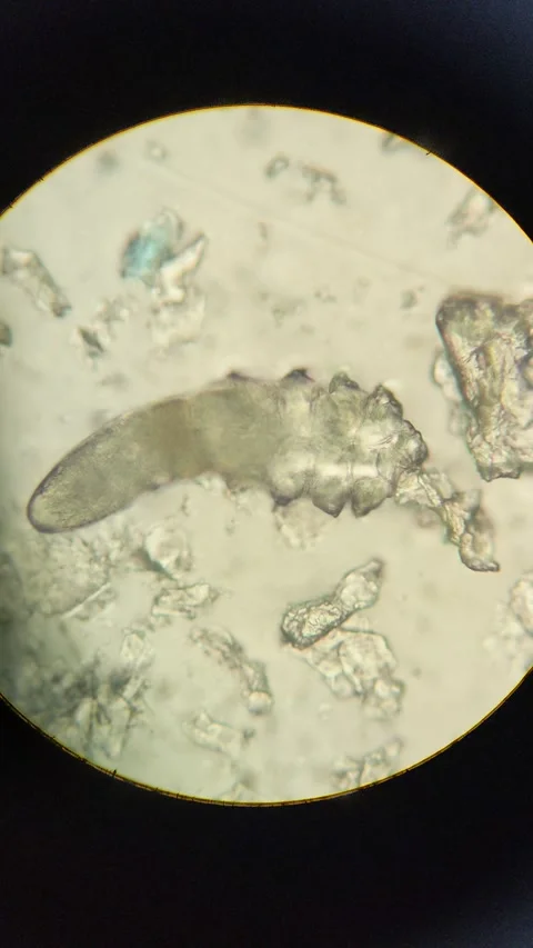 Demodex Face Mite Under the Microscope | Stock Video | Pond5