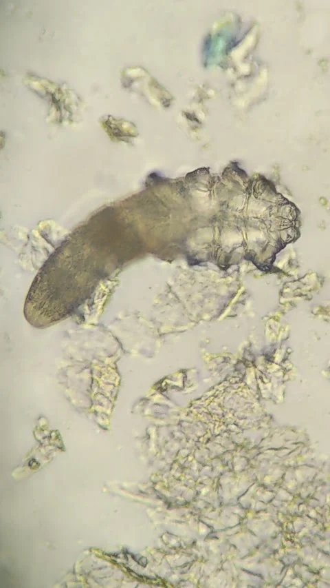 Demodex Face Mite Under the Microscope | Stock Video | Pond5
