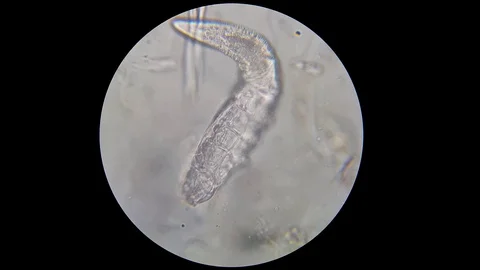 demodex under microscope | Stock Video | Pond5