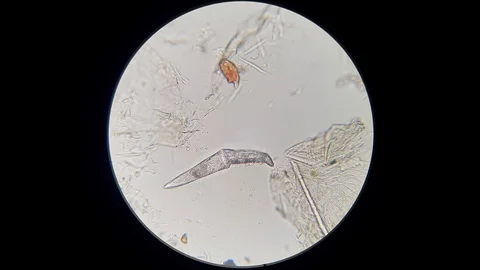 demodex under microscope | Stock Video | Pond5