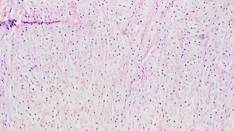Human Tissue Stock Footage ~ Royalty Free Stock Videos | Pond5
