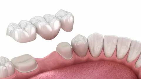 2D Animation Dental Stock Footage ~ Royalty Free Stock Videos | Pond5