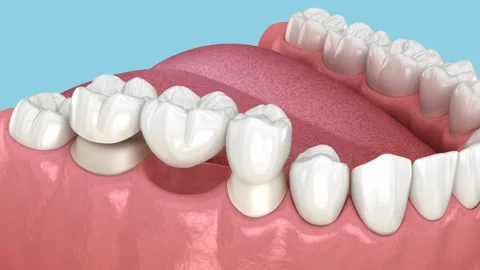Dental Animation Stock Footage ~ Royalty Free Stock Videos | Pond5