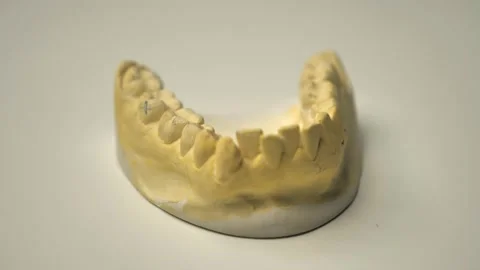 Dental cast of teeth made of plaster for... | Stock Video | Pond5
