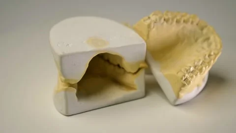 Dental cast of teeth made of plaster for... | Stock Video | Pond5