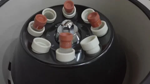 Clotting Stock Video Footage | Royalty Free Clotting Videos | Pond5