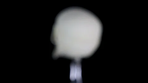 Dental model of human skull spinning aga... | Stock Video | Pond5