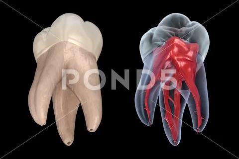 Dental root anatomy - First maxillary molar tooth. Medically accurate ...