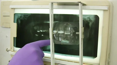 Dentist X Ray Stock Footage ~ Royalty Free Stock Videos | Pond5