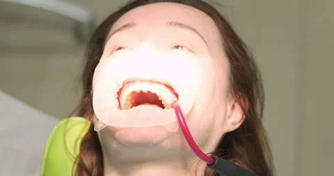 Dentist begins treatment of the patient.... | Stock Video | Pond5