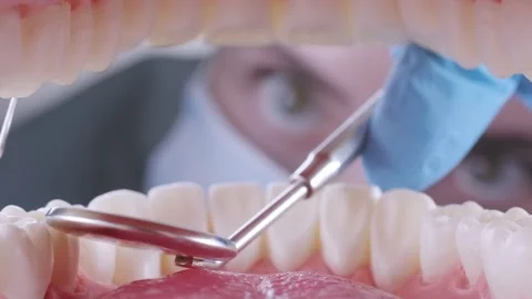 Dentist inspects patient's teeth with pr... | Stock Video | Pond5