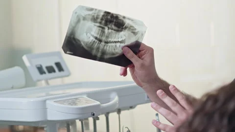 Dentist looking at dental x-ray plate. D... | Stock Video | Pond5