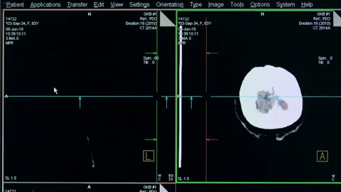 Depiction of a human brain case is being... | Stock Video | Pond5