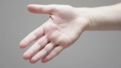 dermatitis, psoriasis eczema dry skin pa... | Stock Video | Pond5