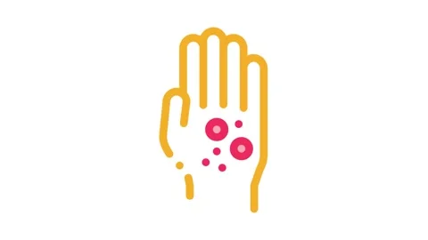 dermatitis rash on hands Icon Animation | Stock Video | Pond5