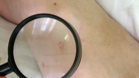 A dermatologist examines a patient's ski... | Stock Video | Pond5