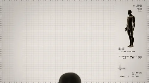 Osteoporosis Background Stock Footage ~ Royalty Free Stock Videos | Pond5