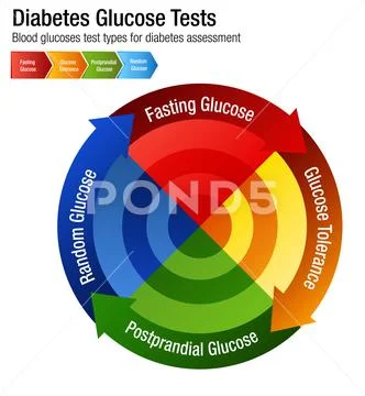 Diabetes Blood Glucose Test Types Chart: Royalty Free #87033538