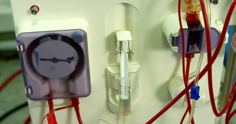 Video Of Dialysis Stock Videos – Royalty-Free HD & 4K Videos