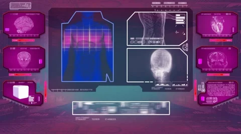 Digestion Analysis - High Tech Scan - P... | Stock Video | Pond5