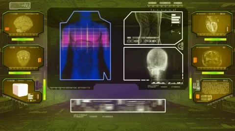 Digestion Analysis - High Tech Scan - Y... | Stock Video | Pond5