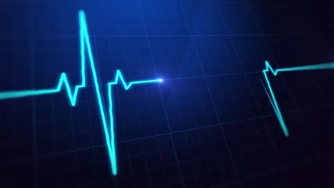Digital EKG Pulse Screen in a 3D animati... | Stock Video | Pond5