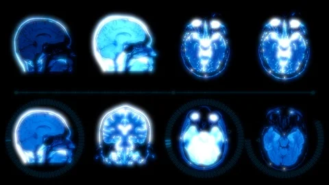 Digital MRI Scan Data of Human Brain | Stock Video | Pond5