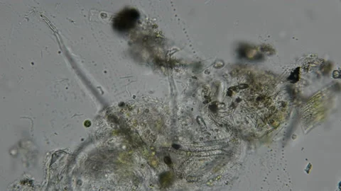 Dirty Drop Of Water Under A Microscope Stock Videos – Royalty-Free HD ...