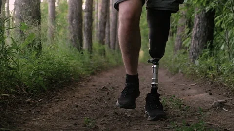 Prosthetic Limb Stock Footage ~ Royalty Free Stock Videos | Pond5
