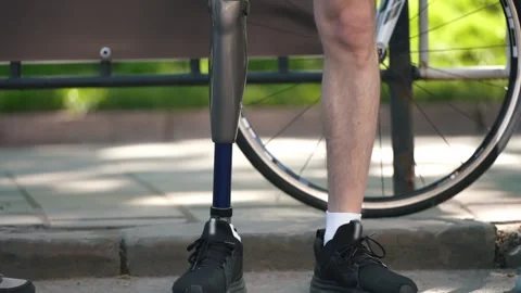 A disabled person with a prosthetic leg.... | Stock Video | Pond5