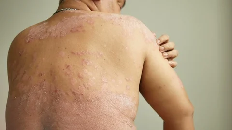 Diseases caused by abnormalities of the ... | Stock Video | Pond5