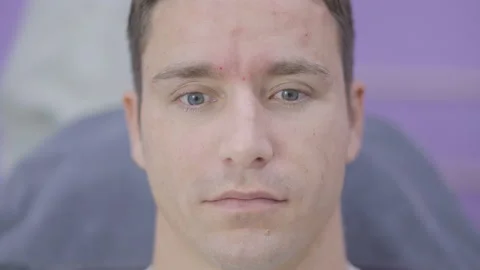 Disoriented man with red spots on face a... | Stock Video | Pond5